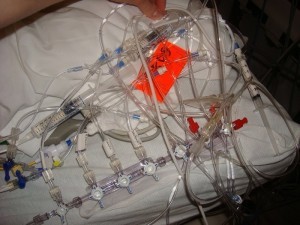 ICU Team Excited to Untangle Lines After Patient Dropped Off from OR ...